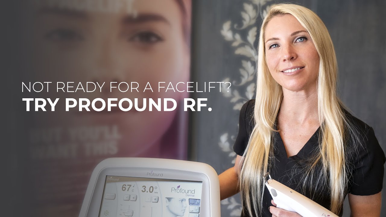 Non-Surgical Facelift Explained: Profound - Microneedling with ...