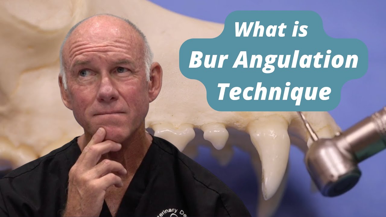 Bur Angulation Technique - YouTube