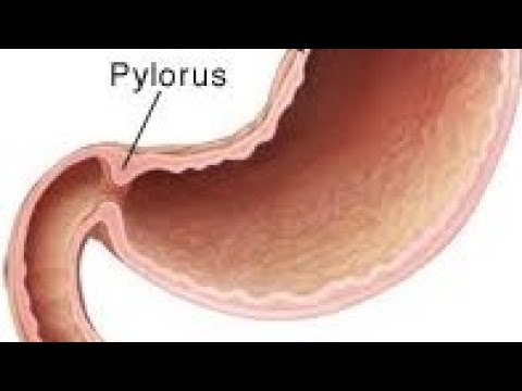 ultrasound video showing normal pylorus in a neonate - YouTube
