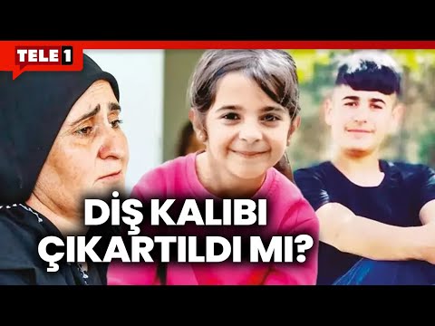 Abideki ısırık izi kimin? Adli Tıp Uzmanı diş izlerini çözümlüyor