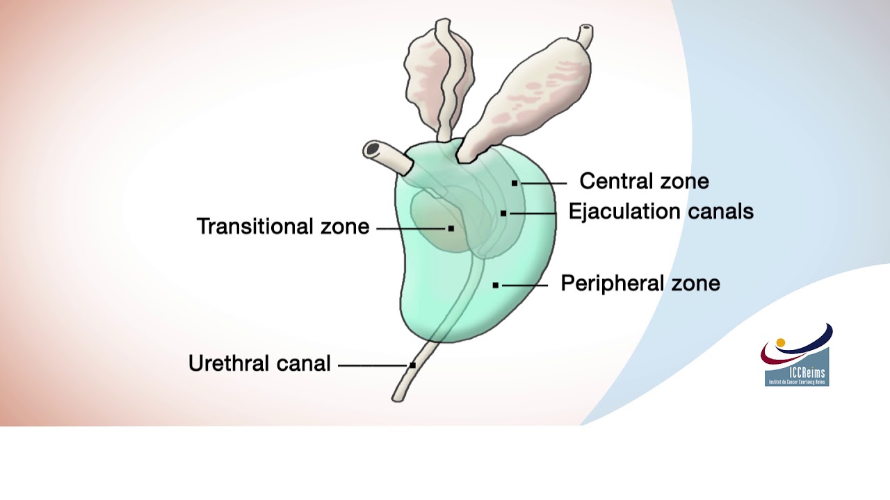 Anatomy of the prostate cancer - YouTube