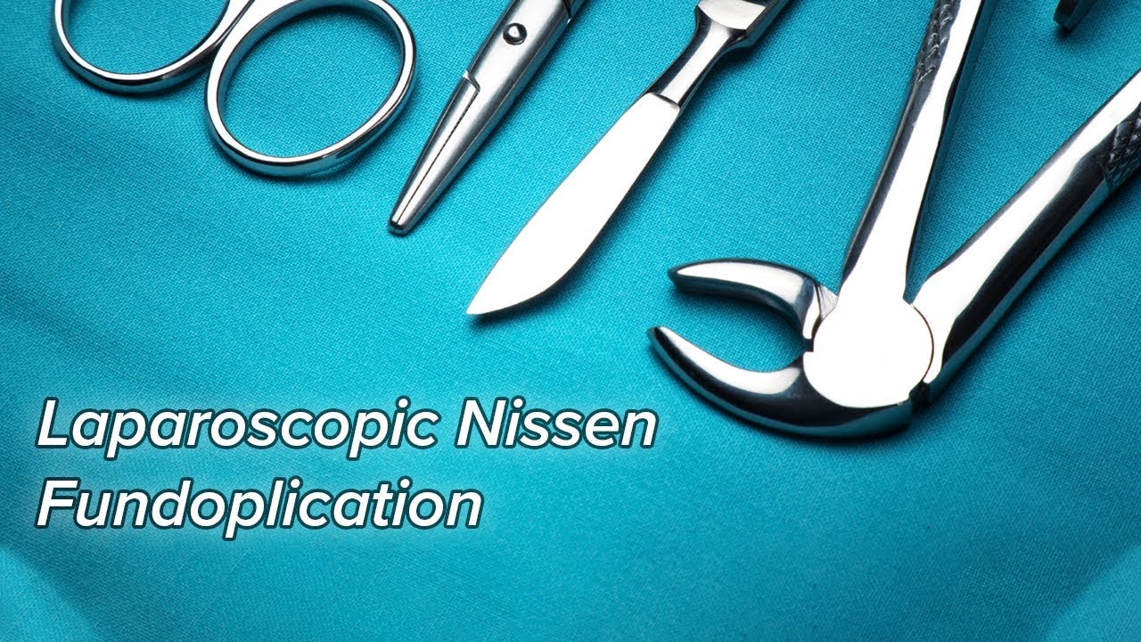 Laparoscopic Collis-Nissen fundoplication - YouTube