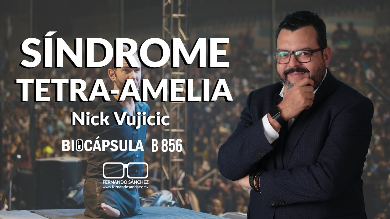 🙏SINDROME TETRAAMELIA Nick Vujicic B856 - Fernando Sánchez ...