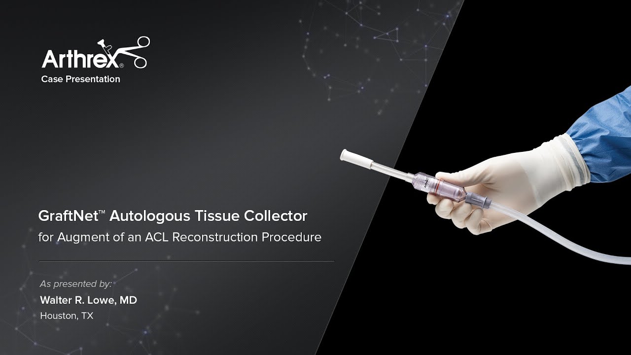 GraftNet™ Autologous Tissue Collector for Augment of an ACL ...