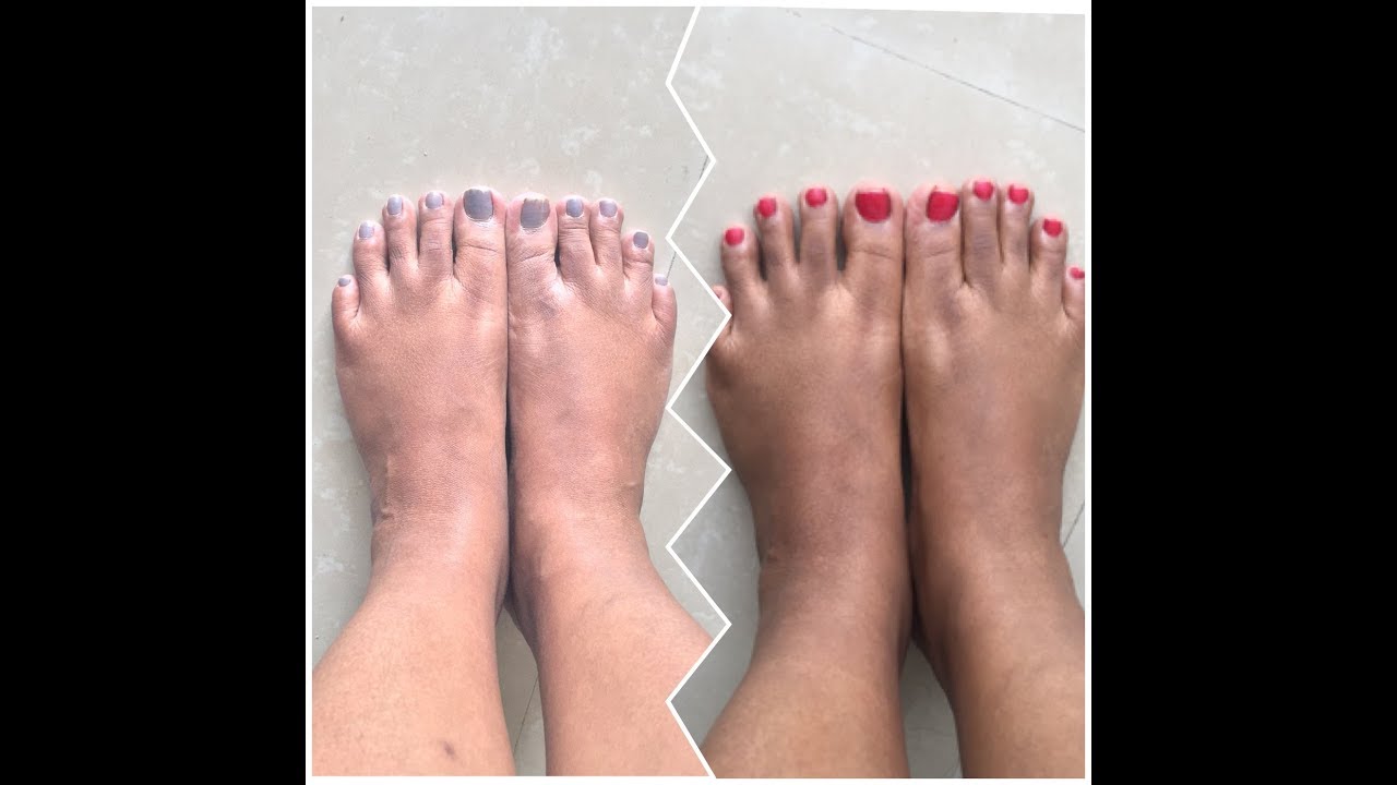 Easy And Simple Pedicure At Home How To Do Simple Pedicure At Home In Telugu YouTube easy-and-simple-pedicure-at-home-how-to-do-simple-pedicure-at-home-in-telugu-youtube