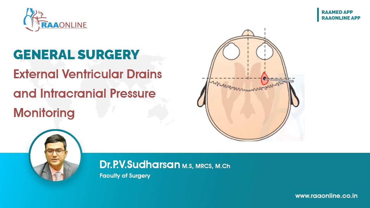 External Ventricular Drains and Intracranial Pressure Monitoring - YouTube