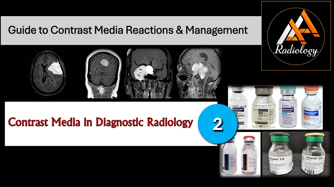 2 - Guide to Contrast Media Reactions and Management - YouTube