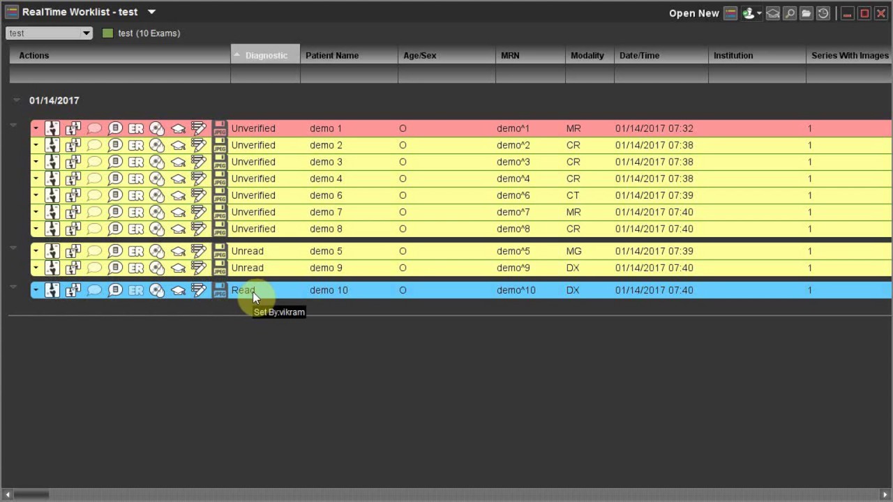 Realtime Worklist Demo - Saince PACS - YouTube