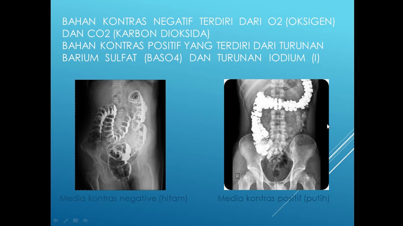 Farmakologi media kontras dalam Radiografi - YouTube