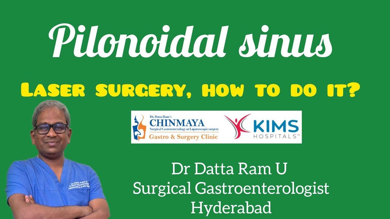 Pilonidal sinus laser surgery| Best treatment - YouTube