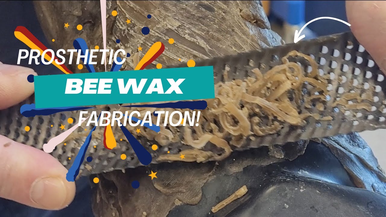 Trans-radial Wax Shaping Technique! - YouTube