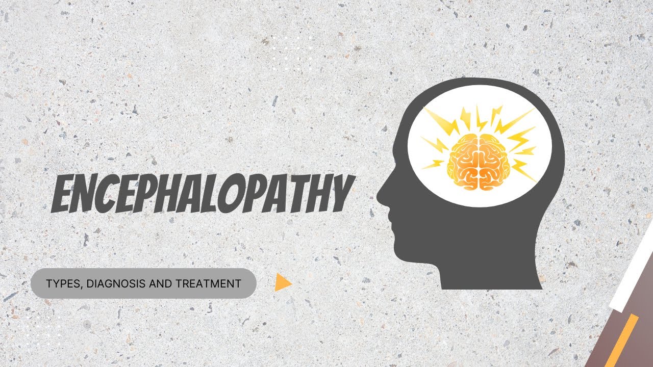 Encephalopathy: types, diagnosis and treatment options - YouTube