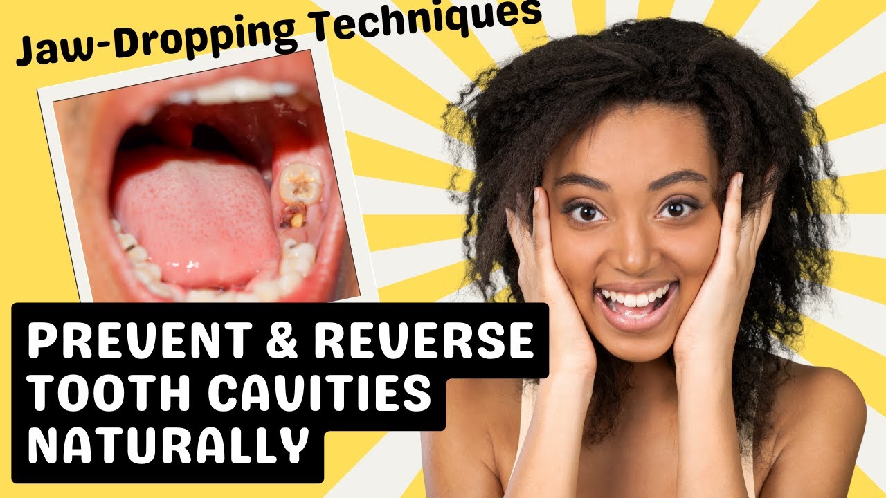 How to Prevent and Reverse Tooth Cavities & Dental Disease NATURALLY ...
