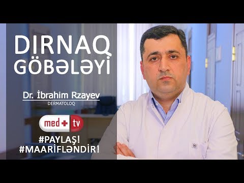 Dirnaq gobeleyi xesteliyi / Dırnaq göbələyi / Dermatoloq İbrahim Rzayev / MEDPLUS #I3