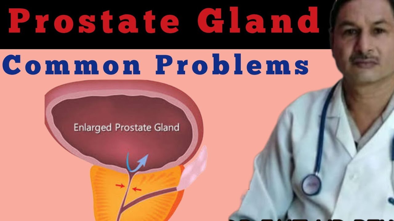 prostate gland kya hai | Prostate Grand and Urinary Problems Treatments | urdu/hindi @Shaikhain ...