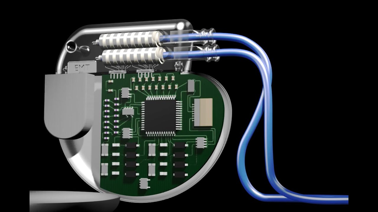 Trade Show Animation for a Pacemaker Company - YouTube