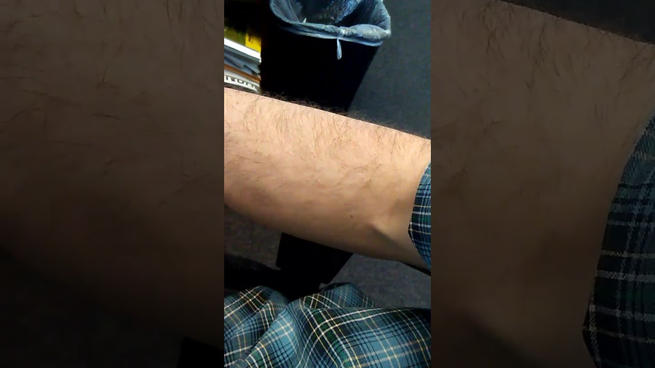 Arm Spasm YouTube arm-spasm-youtube