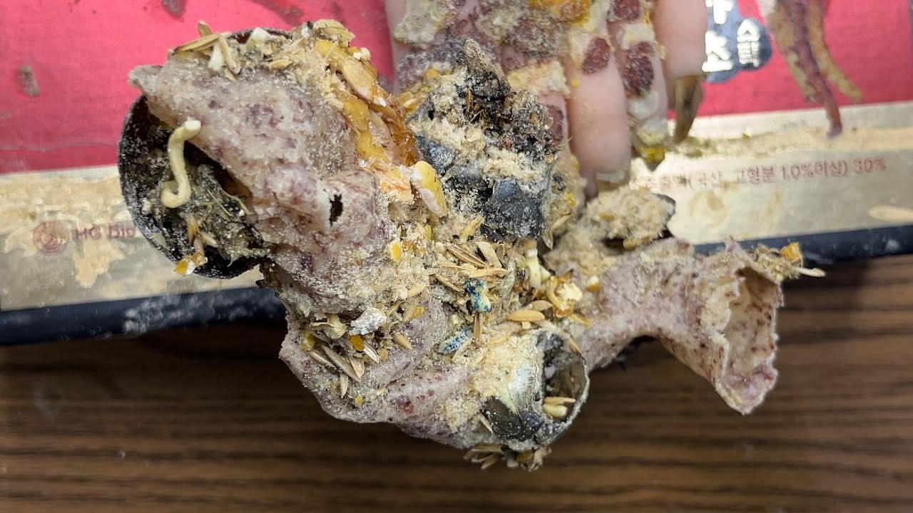 INGROWN TOENAILS, The nail is embedded super deep and there is a hole ...