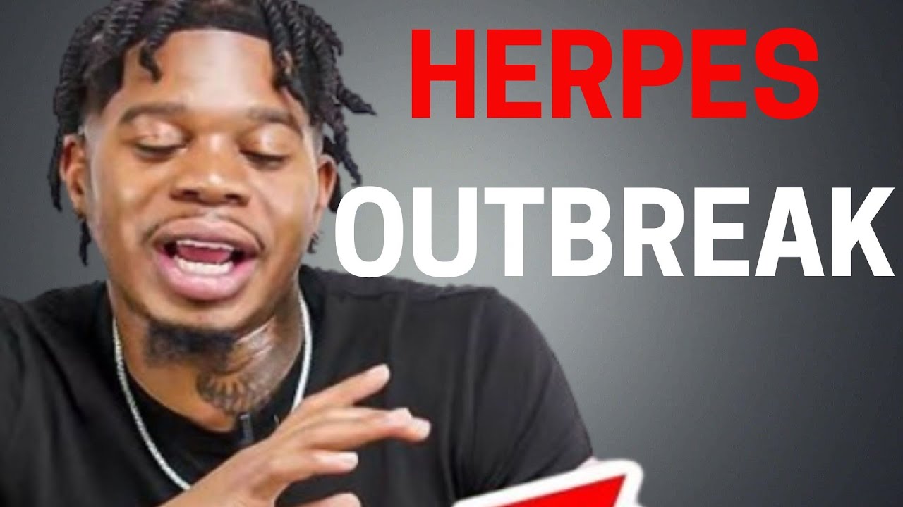 Gucci Third Leg Gives Everyone Herpes Youtube