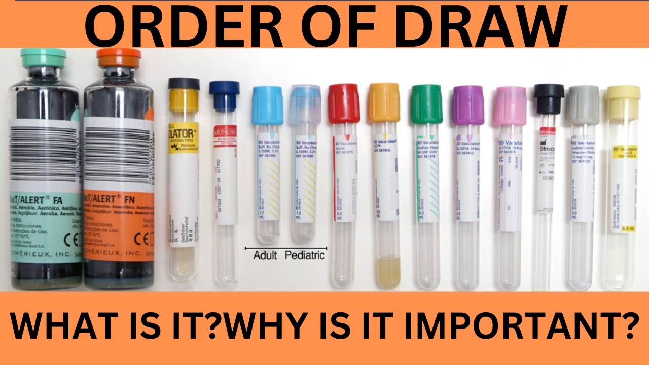 ORDER OF (BLOOD)DRAW WHY DO WE NEED IT?ADVANTAGES AND METHOD TO DRAW ...