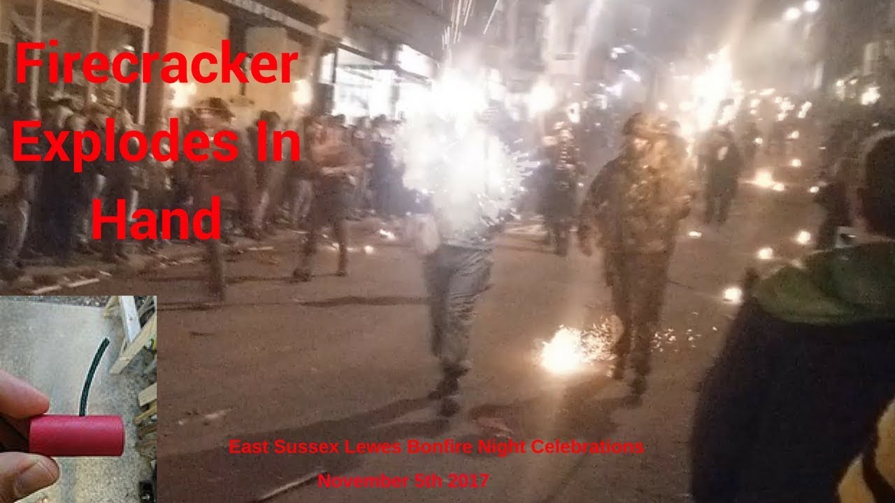 Firecracker Explodes In Hand - YouTube
