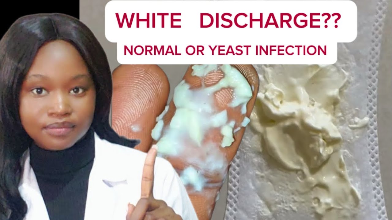 How To Stop Vaginal Yeast Infection & Itching / Is White Discharge ...