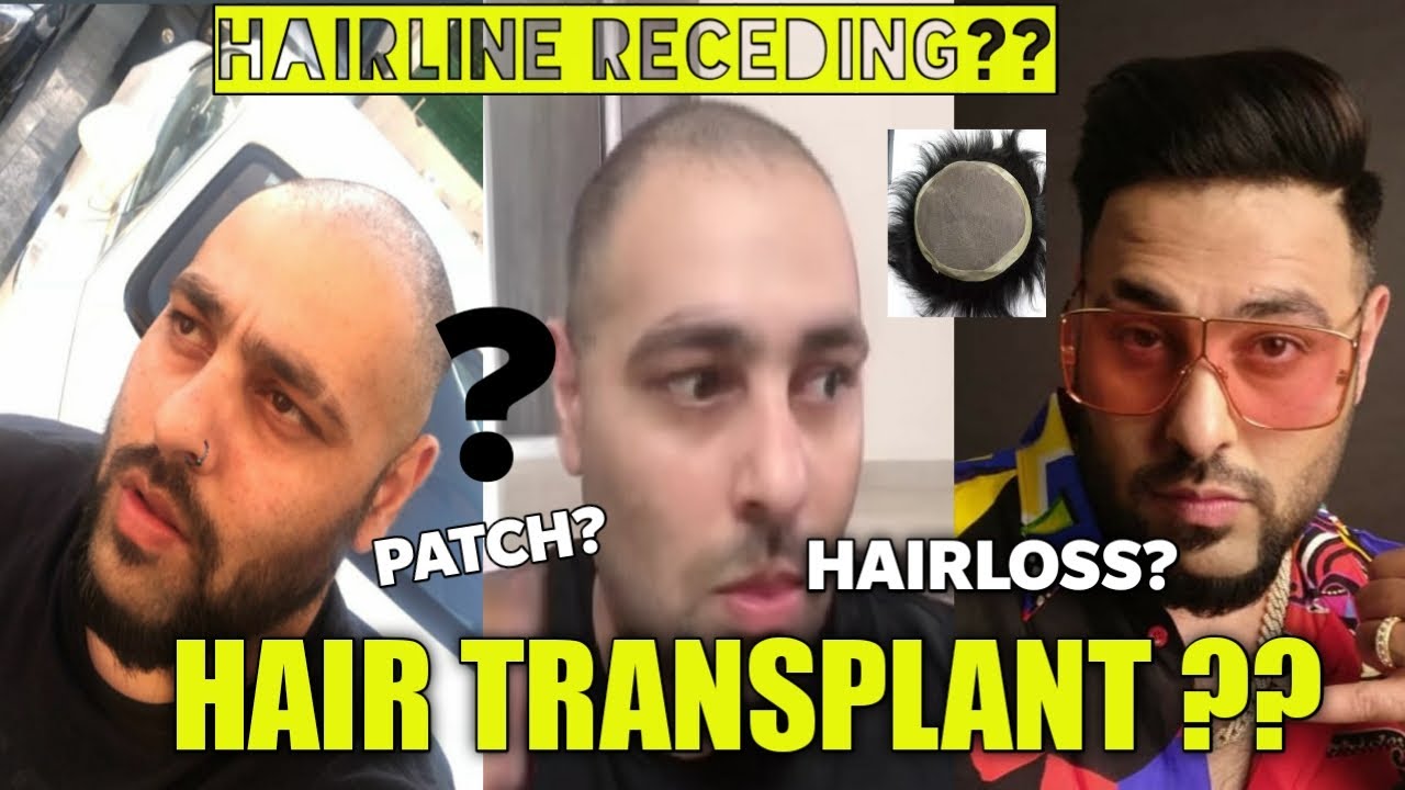 BADSHAH HAIR TRANSPLANT | Hairfall | Hairloss | Badshah hairstyle ...
