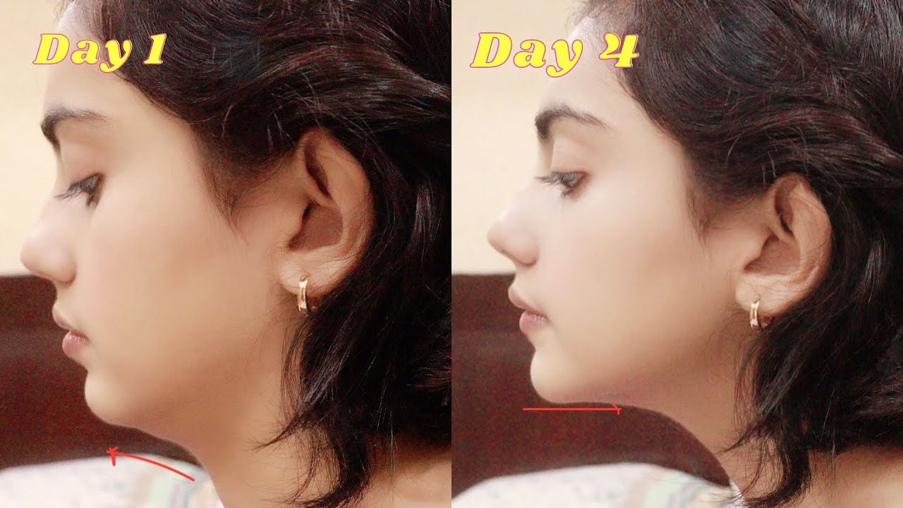 7 Days challenge for flat chin with only three simple poses | Get rid ...