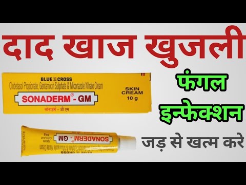 Sonaderm GM Skin Cream Uses | फंगल इनफेक्शन दाद खाज खुजली जड़ से खत्म ...