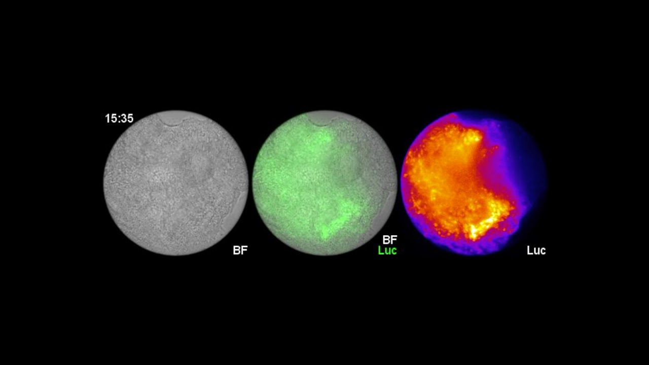 It's about time: a stem cell-derived model of the segmentation clock ...