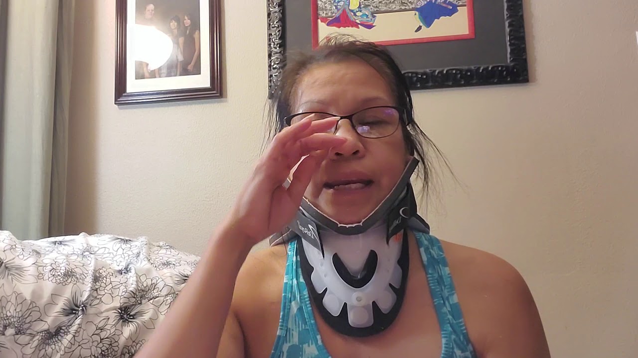 Anterior Cervical Discectomy fusion C6 - C7 ACDF 2nd day post op ...