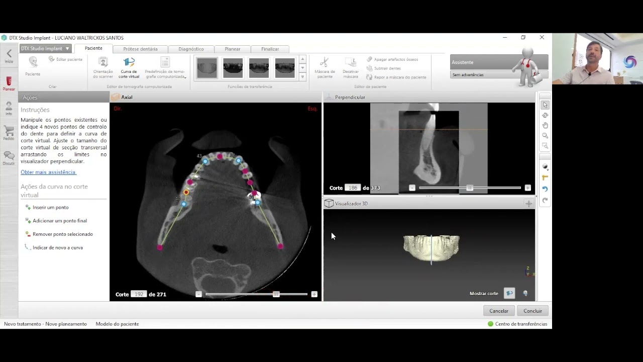 DTX Studio Implant Importando Arquivos STL - YouTube