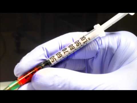 How to take an arterial blood gas sample from the radial artery