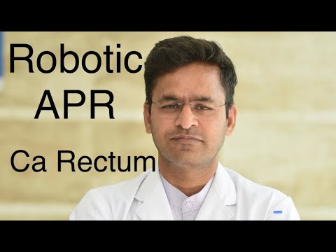 Robotic APR {Abdomino-perineal Resection} for Post CT/RT locally ...