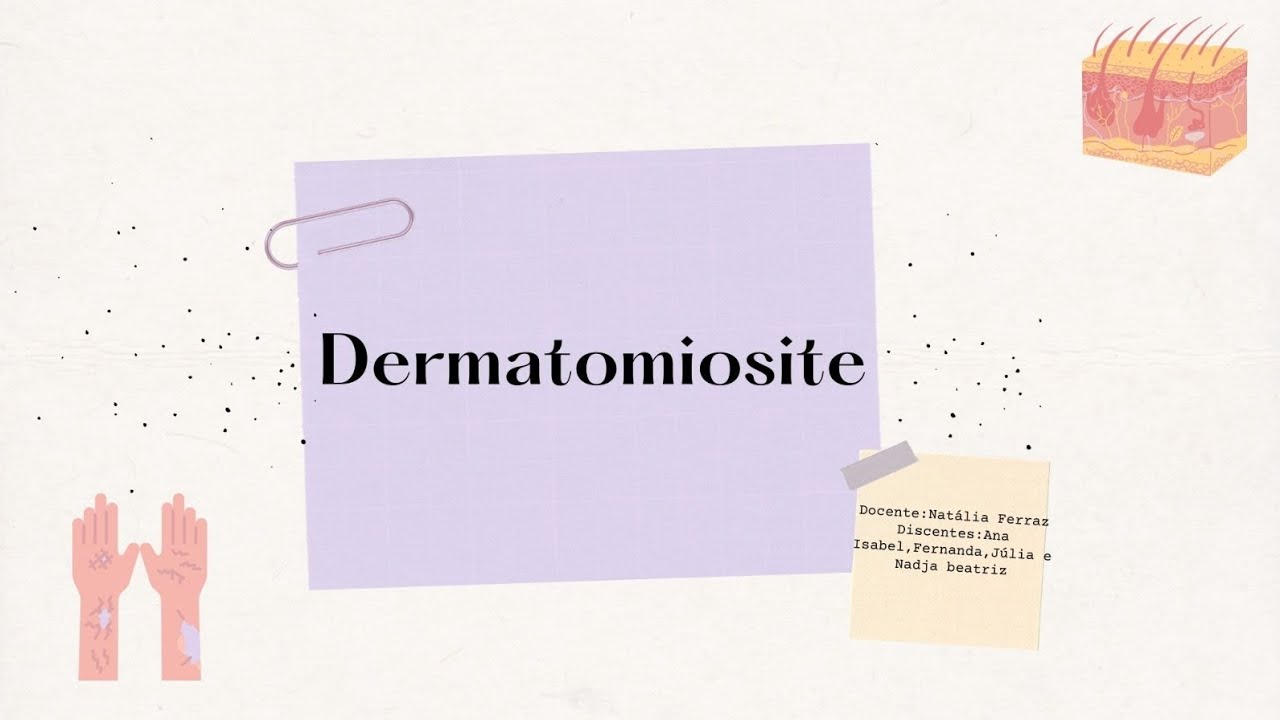 Dermatomiosite - Definição, Características e Tratamento. - YouTube
