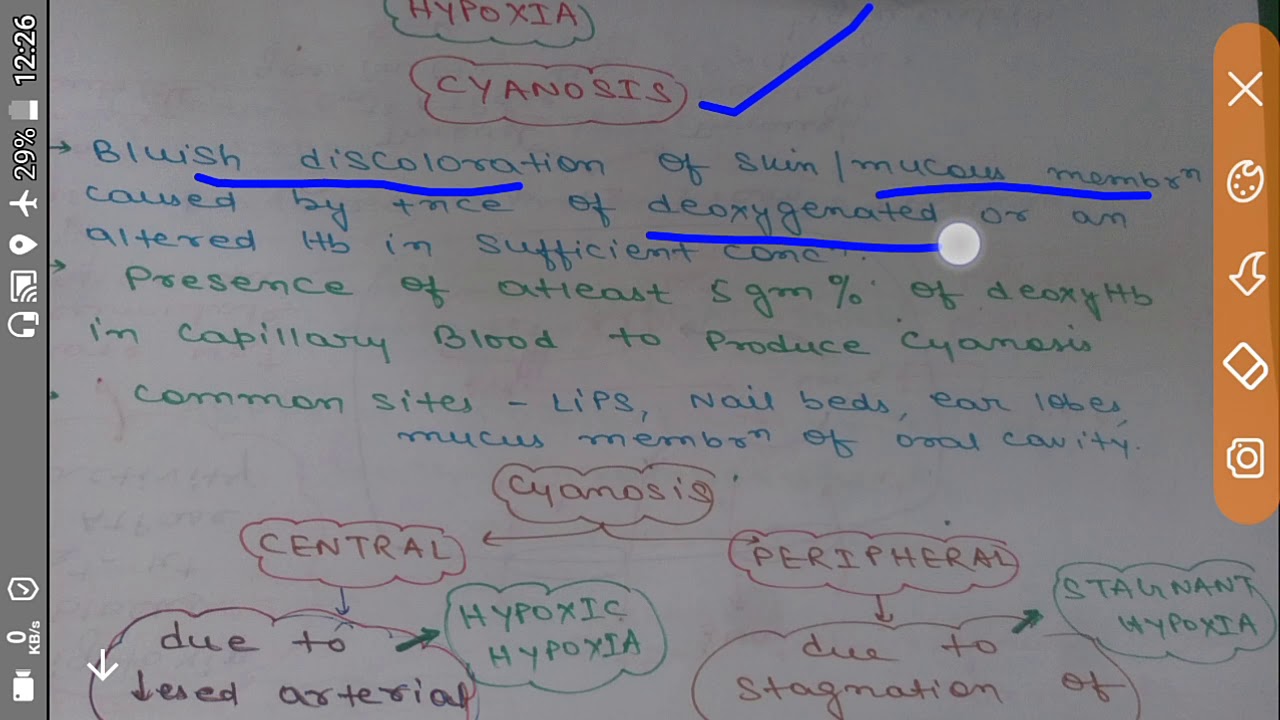 CYANOSIS AND ITS TYPES- CENTRAL and PERIPHERAL - YouTube