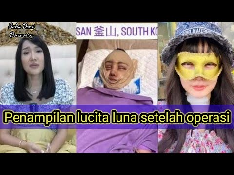 viral ‼️Penampilan baru lucinta luna selesai operasi ‼️ternyata ❗#viral #operasi#lucintaluna
