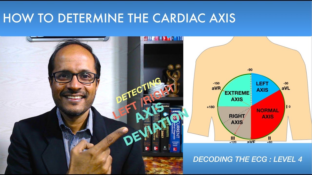 Decoding the ECG / EKG Level 4: Calculate the Axis of the Heart - YouTube