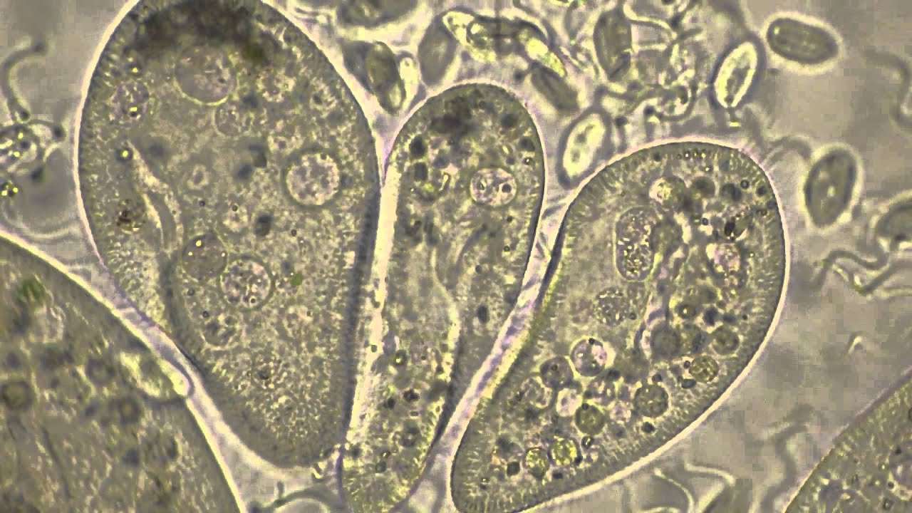 parameci,spirilli piccoli ciliati.MOV - YouTube