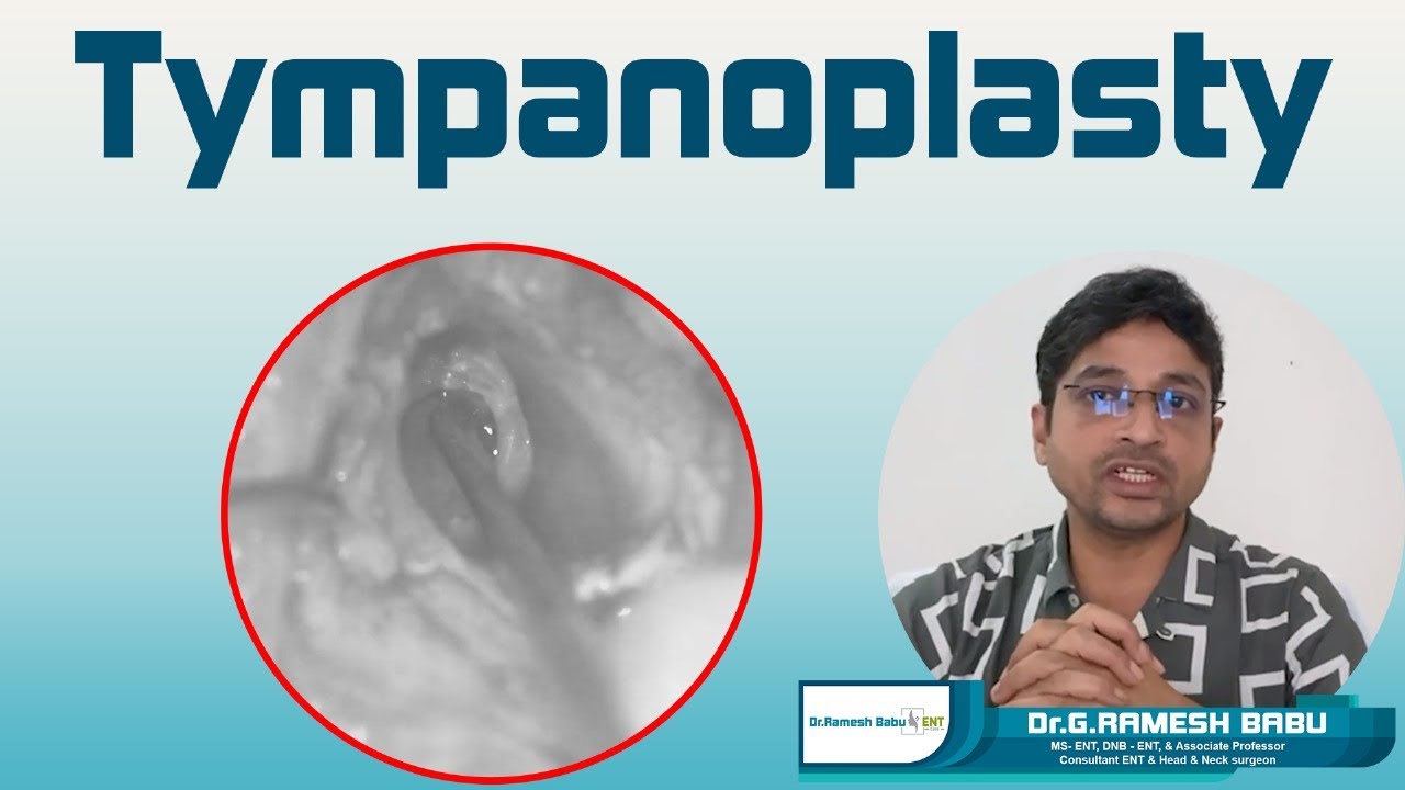 Tympanoplasty: Ear Drum Hole Repair || Dr Ramesh Babu ENT - YouTube