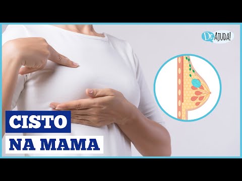 CISTOS NAS MAMAS: O QUE É, DIAGNÓSTICO E TRATAMENTO