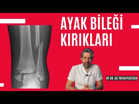 Ayak Bileği Kırıkları