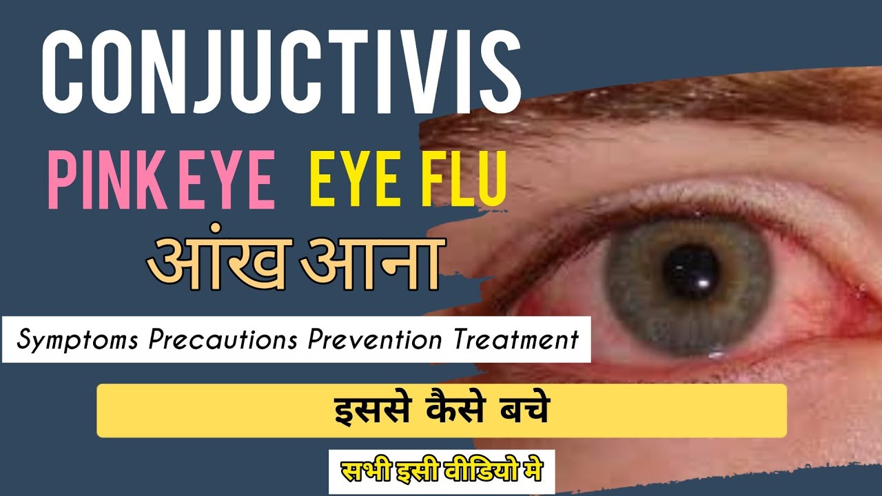आंख आना | Eye Flu | Pink Eye | CONJUCTIVIS | Symptoms Precautions ...