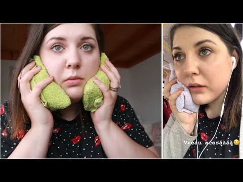 🦷VLOG: Experiența mea cu extracția măselelor de minte (UPDATE zilnic)