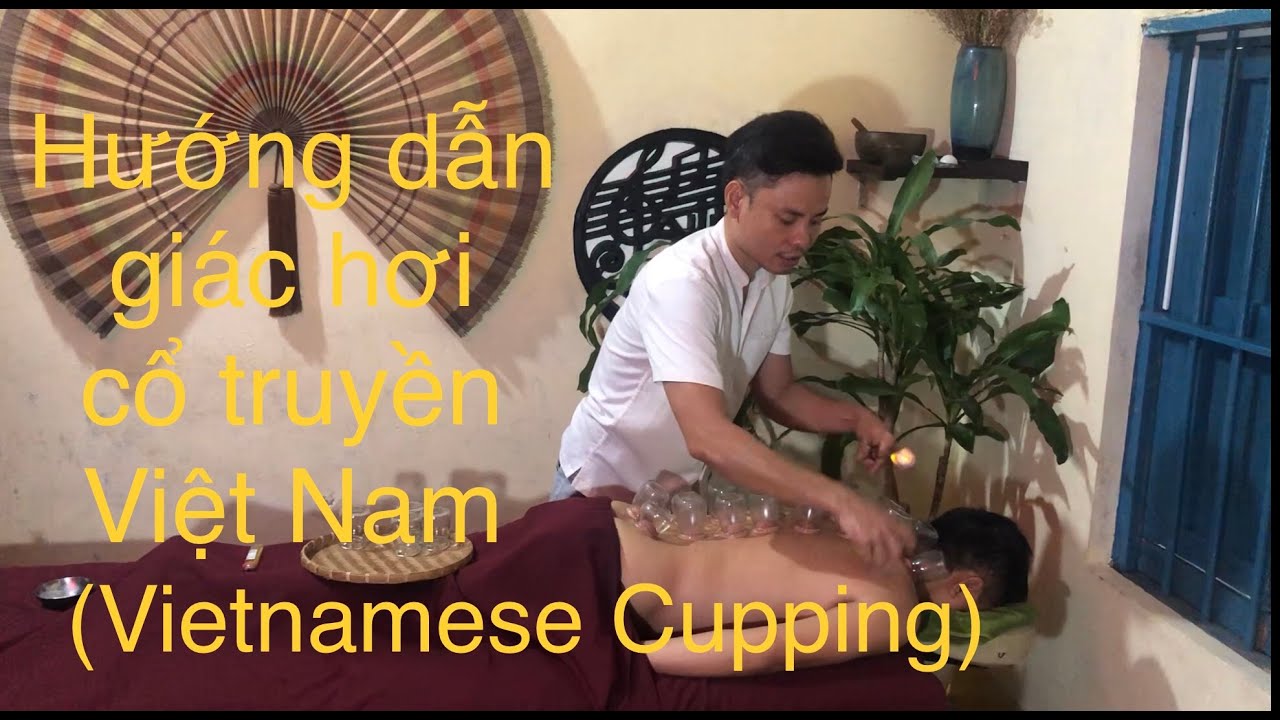 Hướng dẫn giác hơi cổ truyền Việt Nam, Vietnamese cupping therapy - YouTube