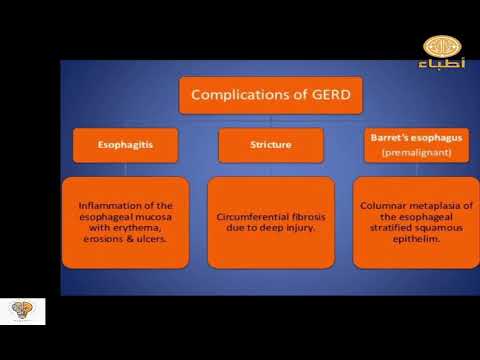 git 1: gastroesophageal reflux disease - YouTube