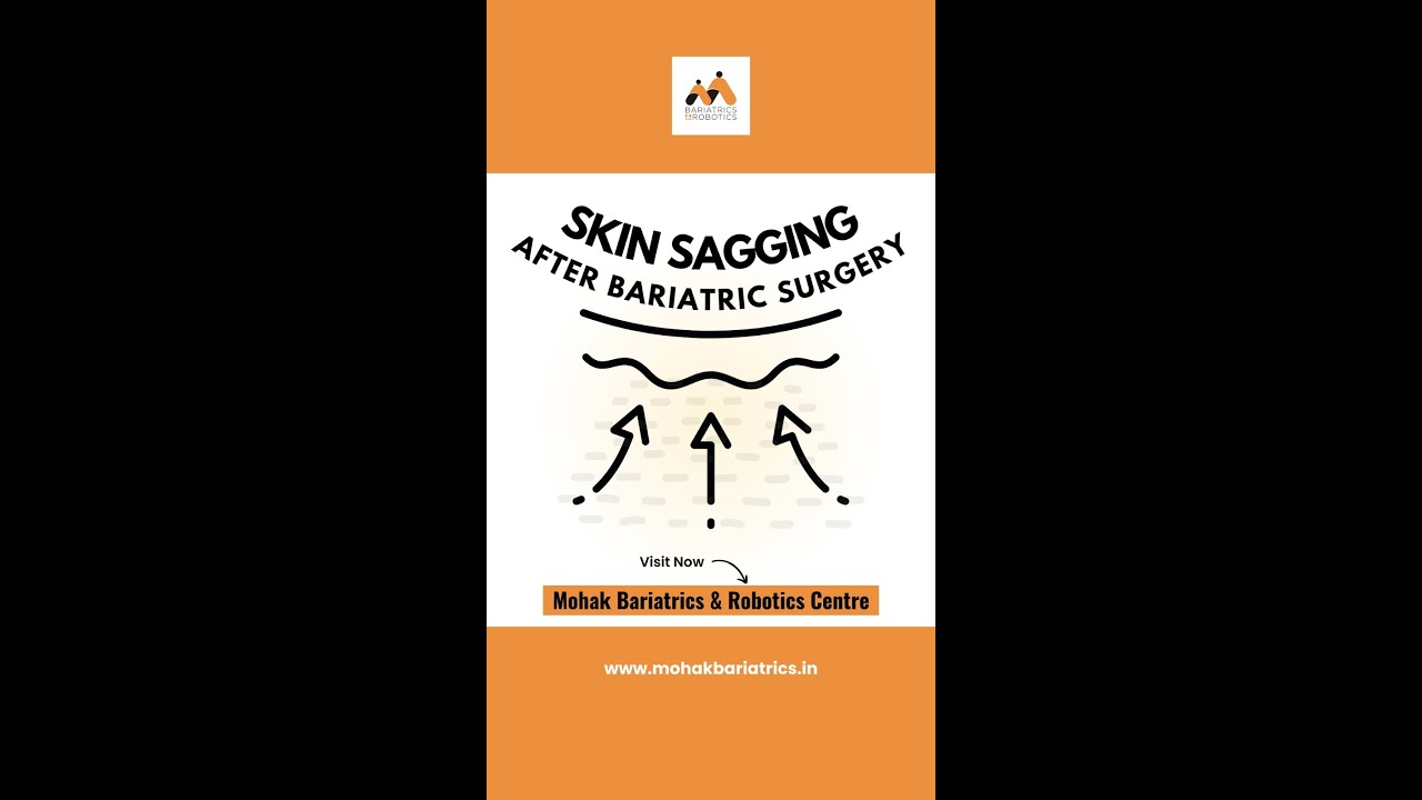 Feeling the effects of skin sagging after your weight loss journey ...