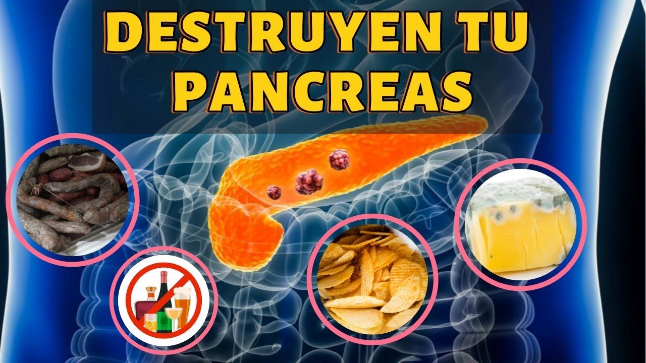 PANCREAS: Los 5 Peores Alimentos que Debes Conocer - YouTube