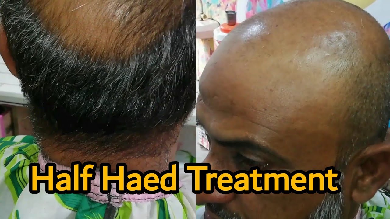 How To half 🔥Head Shave for old Man ||so Amazing old man ||Dandruff ...