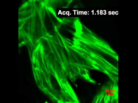 F-Actin Live Cell staining with SiR-Actin in cardiac Myocytes - YouTube